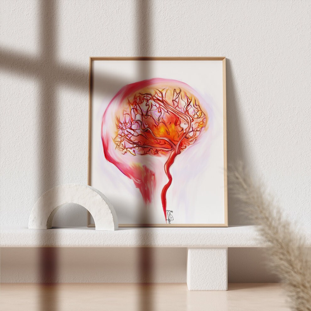 Abstract Cerebral Angiography Art Print-brain Art-neurology | Etsy
