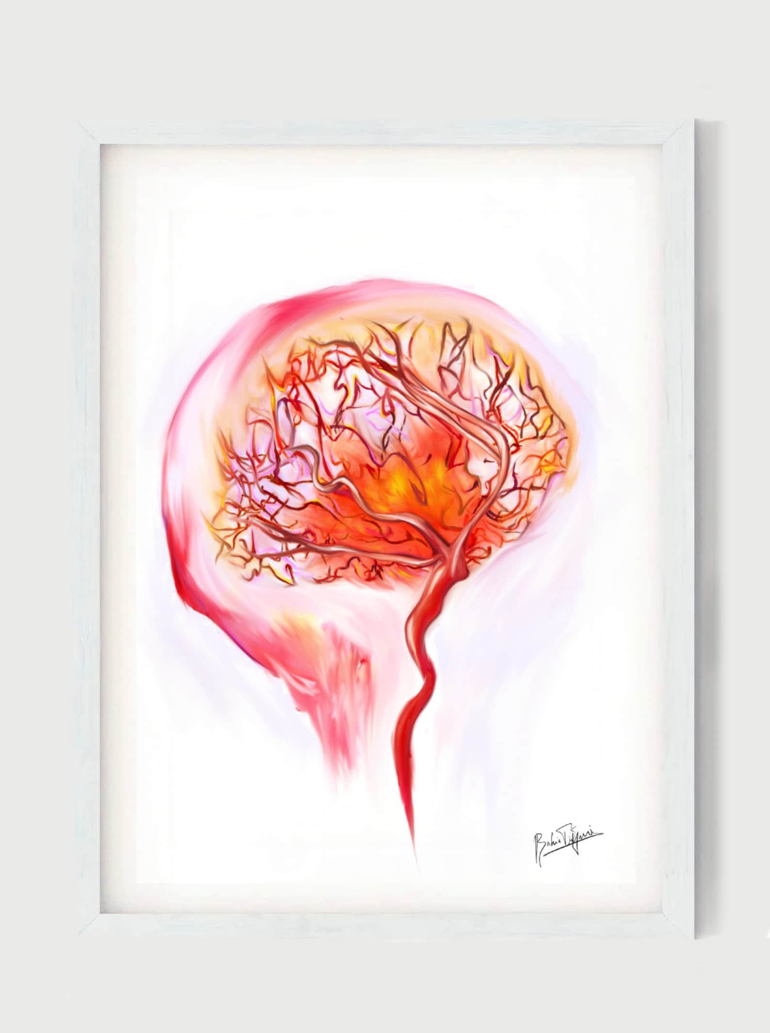 Abstract cerebral angiography art print-Brain Art-Neurology | Etsy