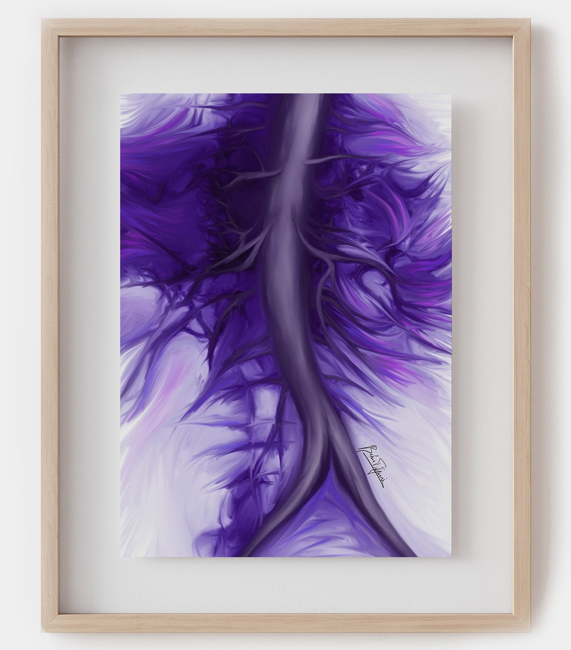 Abdominal Aorta Anatomy Art Print Cardiovascular Wall | Etsy