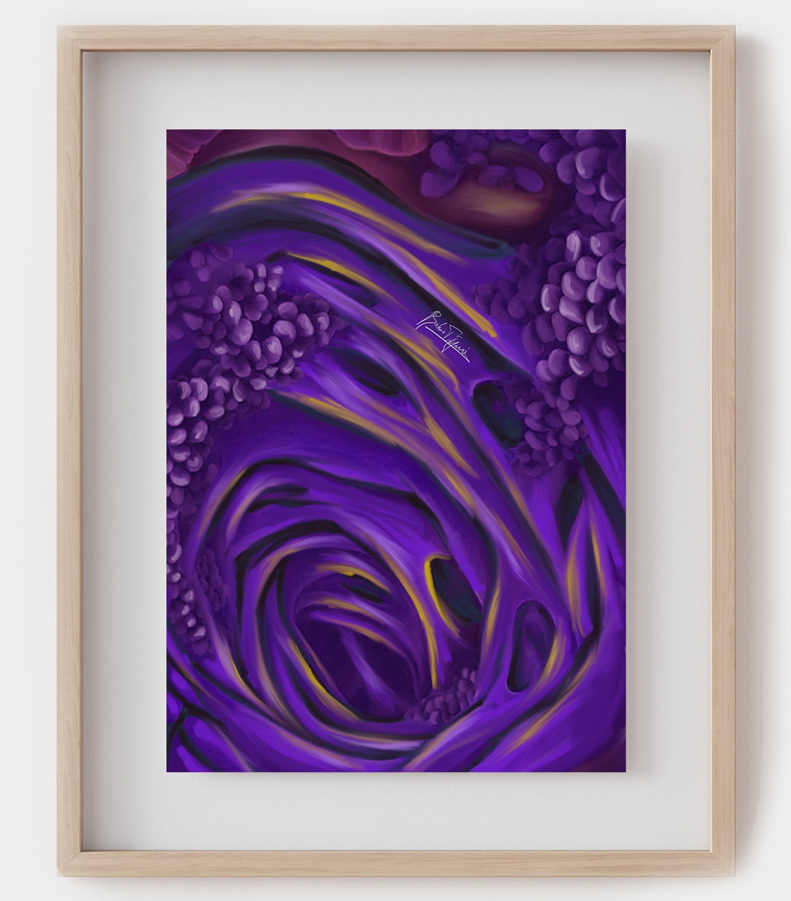 Colonoscopy Abstract Anatomy Art Print gastrointestinal Wall - Etsy