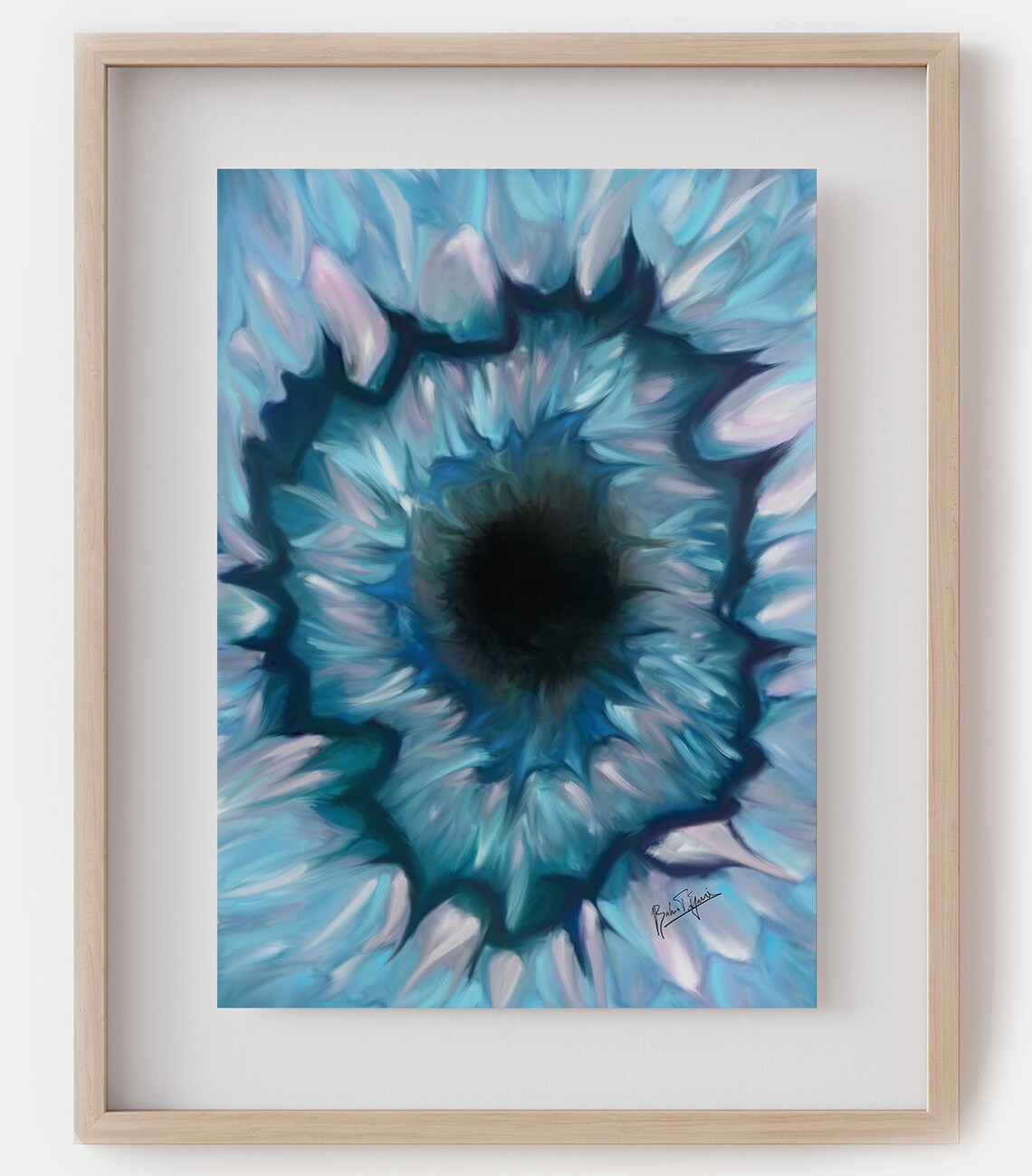 Constricted Iris Anatomy Art Print Optometrist - Etsy