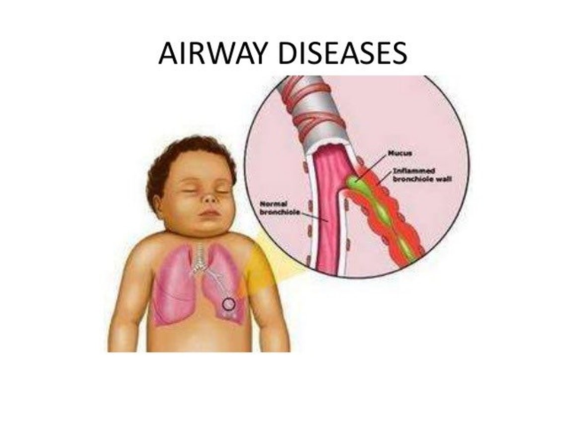 Pediatrics: Children with Respiratory Disorders | Etsy