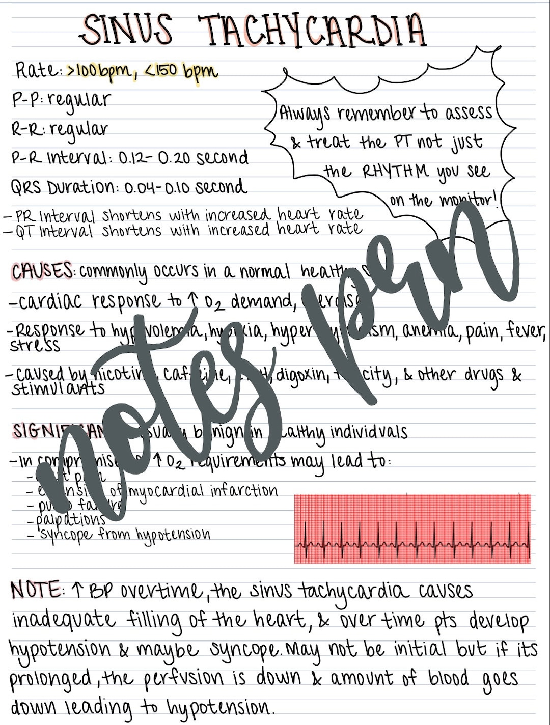 Nursing Notes-sinus Tachycardia - Etsy