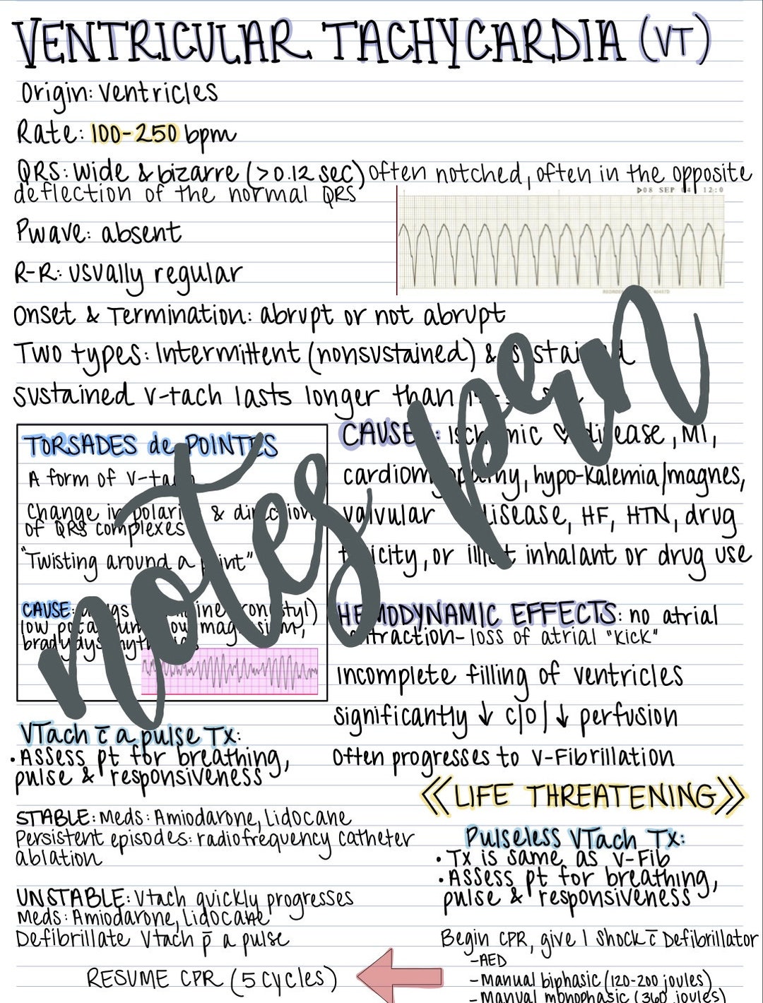 Nursing Notes-ventricular Tachycardia - Etsy