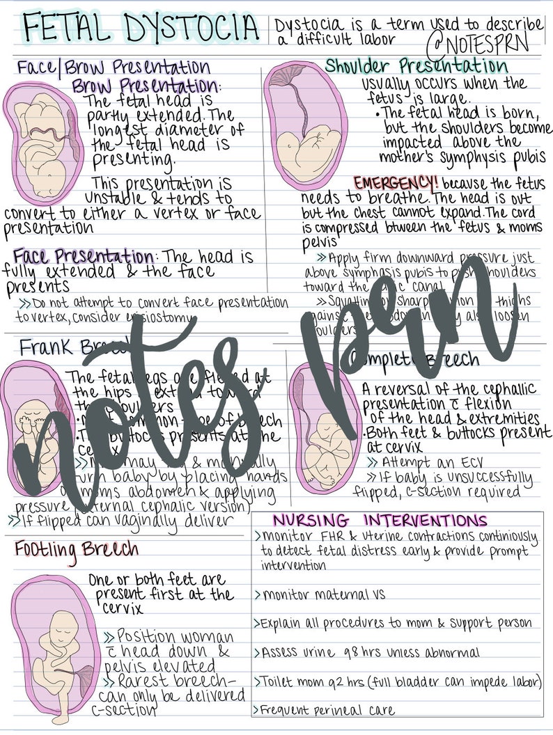 Nursing Notes- Fetal Dystocia - Etsy