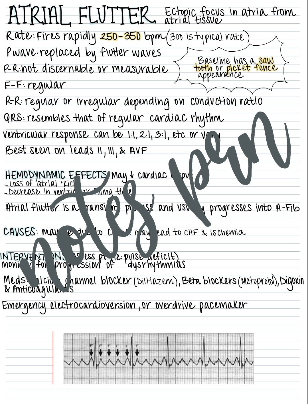 Nursing Notes Atrial Flutter Etsy