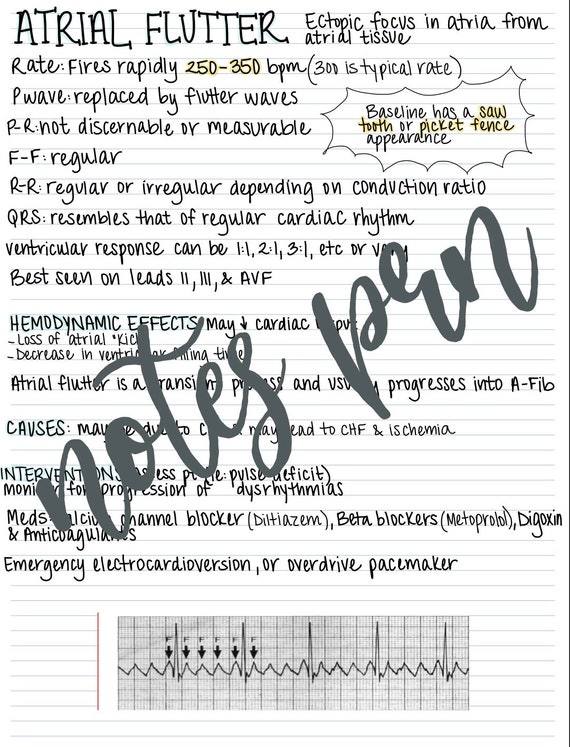 Nursing Notes-atrial Flutter | Etsy