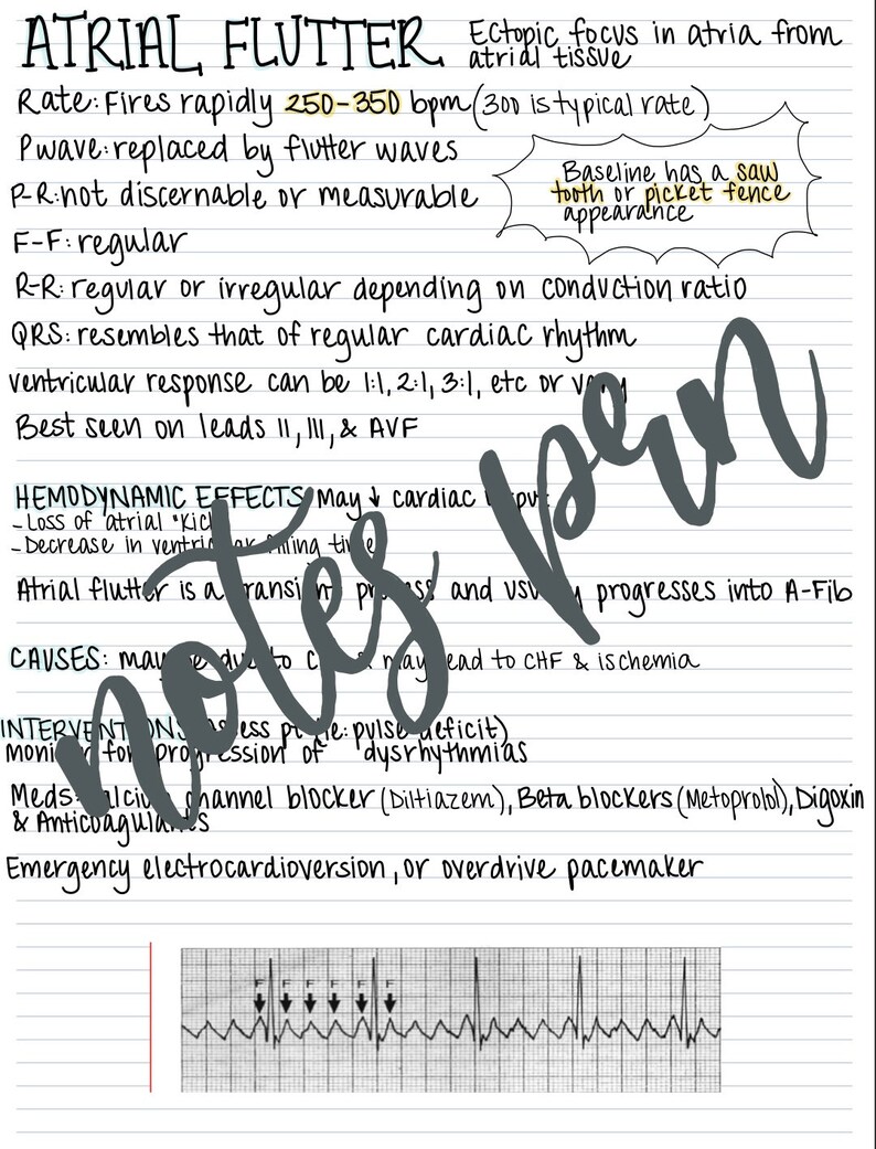 Nursing Notes-atrial Flutter - Etsy