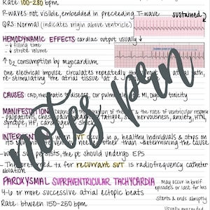 Nursing Notes- Supraventricular Tachycardia - Etsy