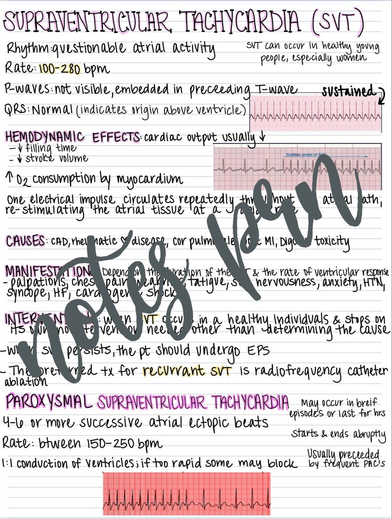 Nursing Notes- Supraventricular Tachycardia - Etsy