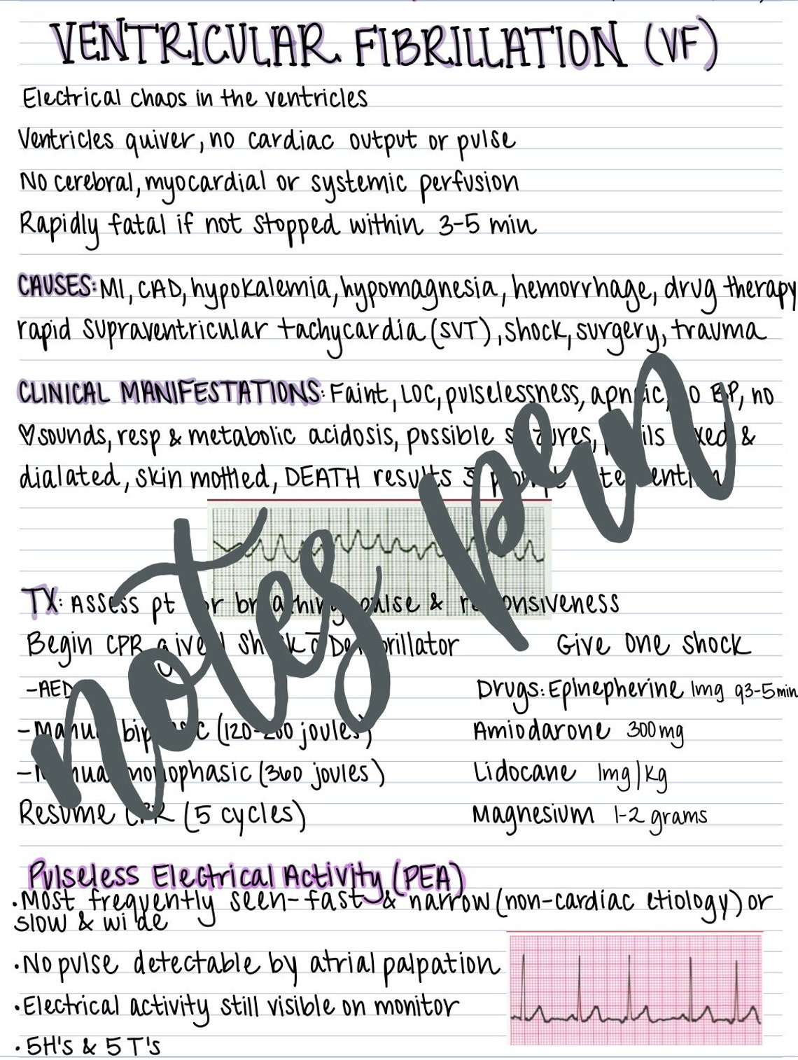 Nursing Notes-ventricular Fibrillation - Etsy