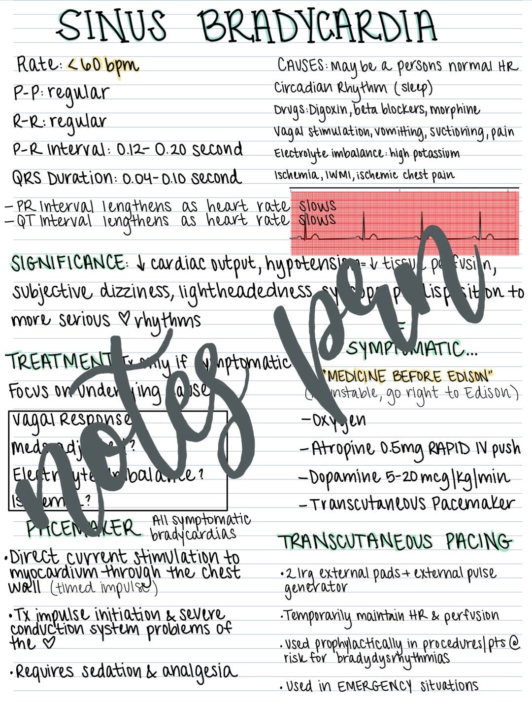 Nursing Notes-sinus Bradycardia - Etsy