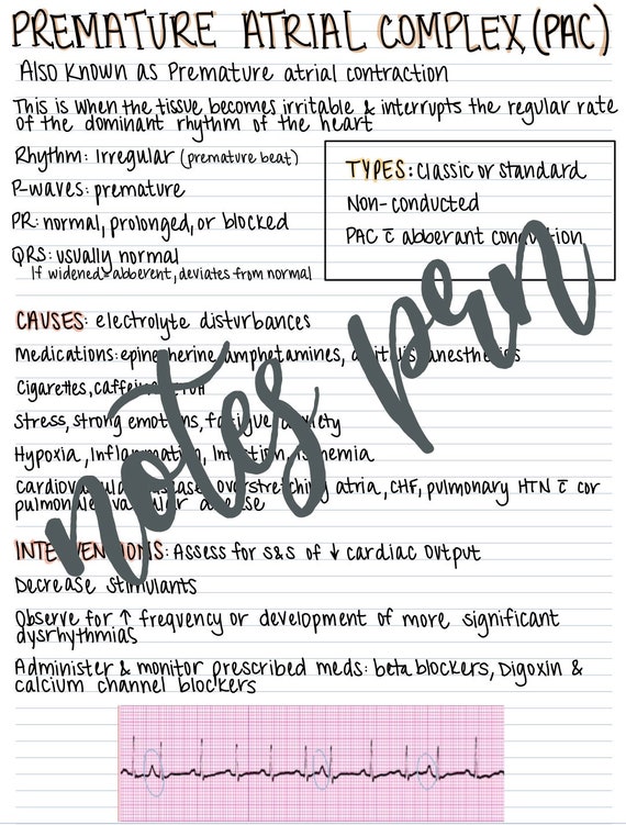 Premature Atrial Complex