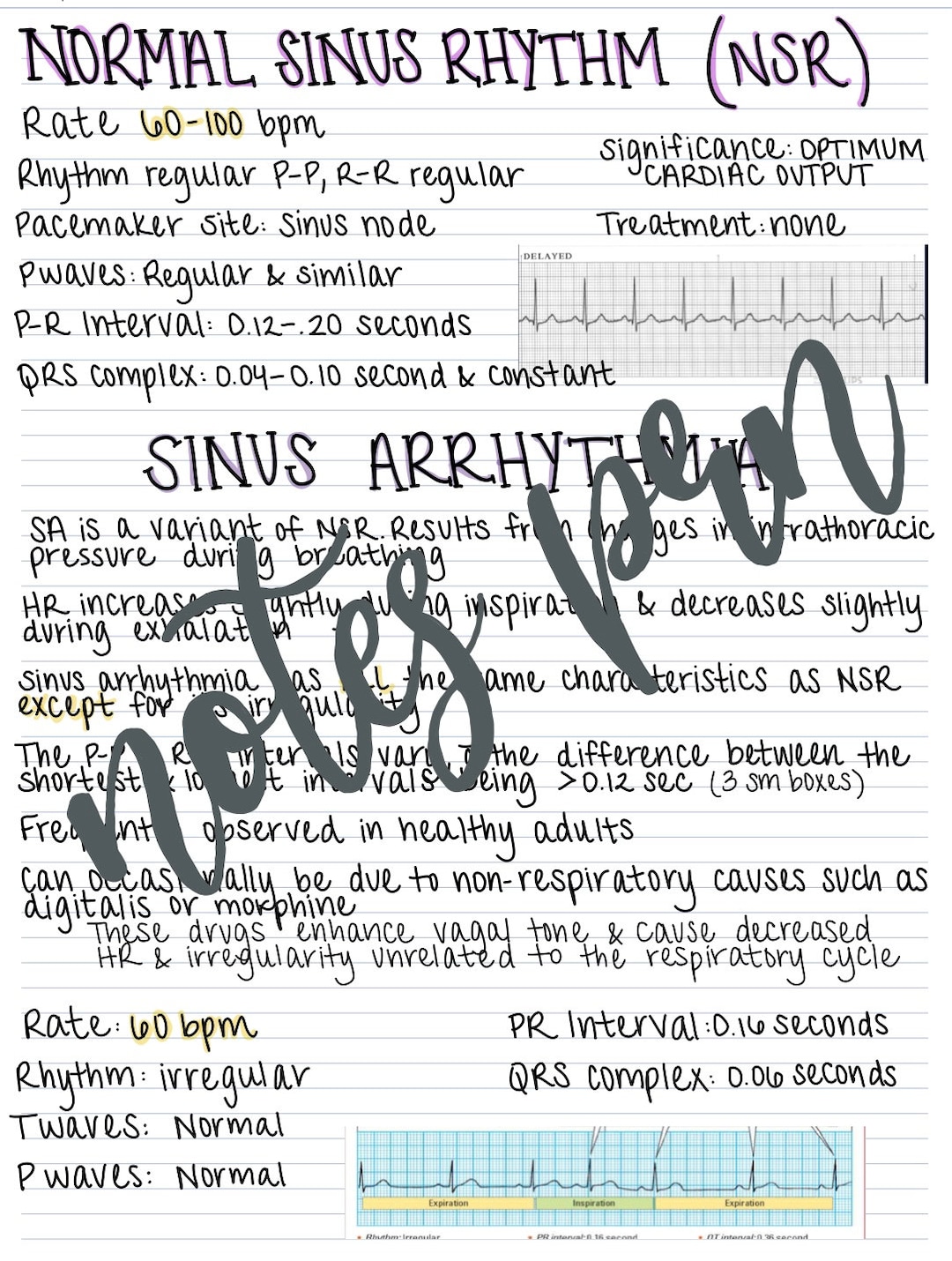 Nursing Notes-normal Sinus Rhythm & Sinus Arrhythmia - Etsy