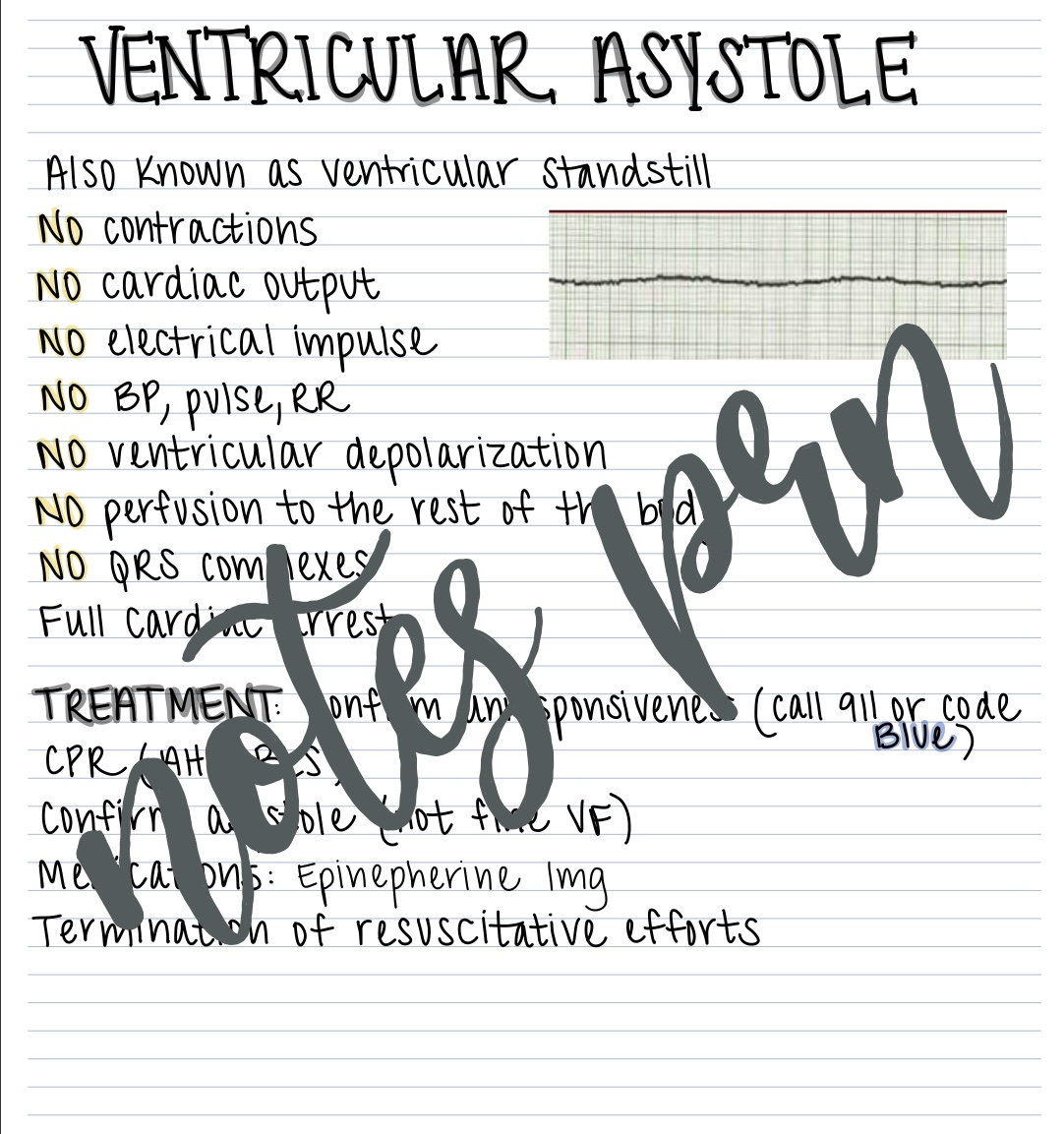 Asystole