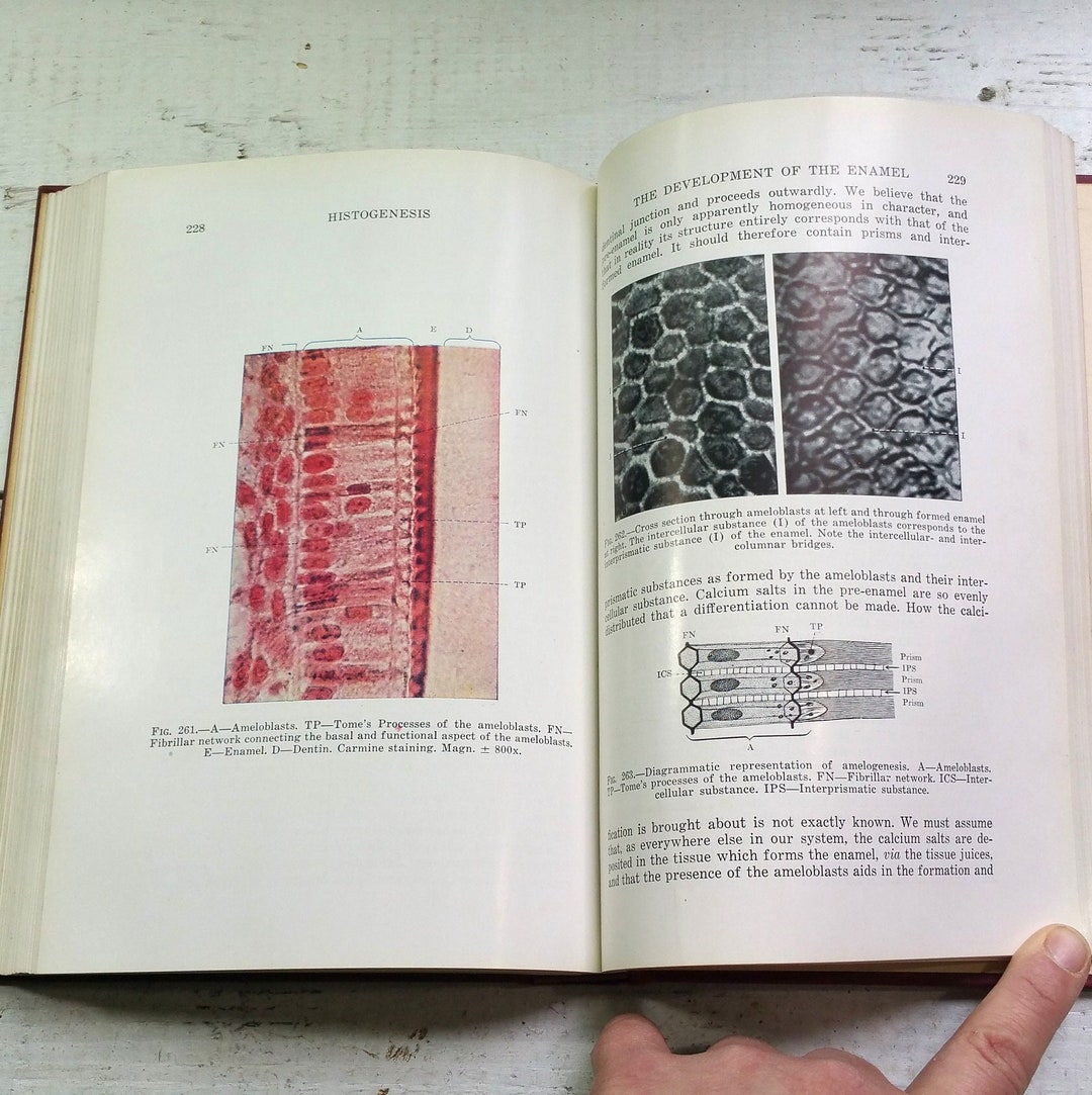 Meyer's Normal Histology and Histogenesis of the Human Teeth ...