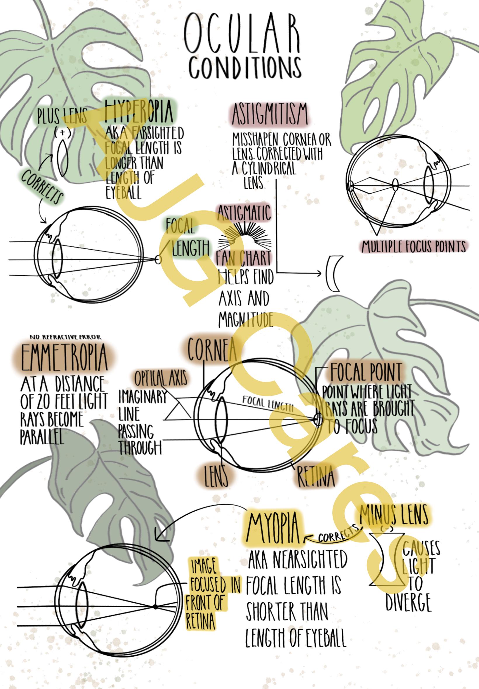 Eye Conditions Digital Poster. - Etsy