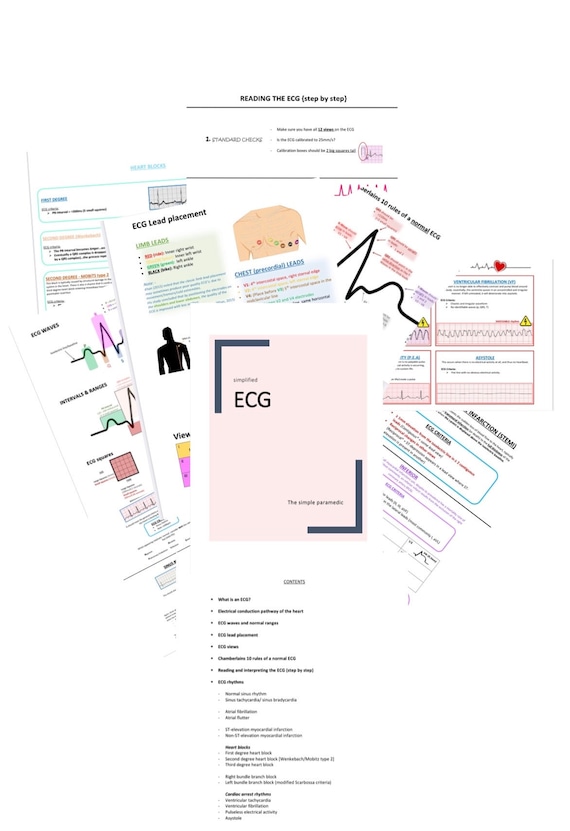 ECG NOTES Printable - Etsy