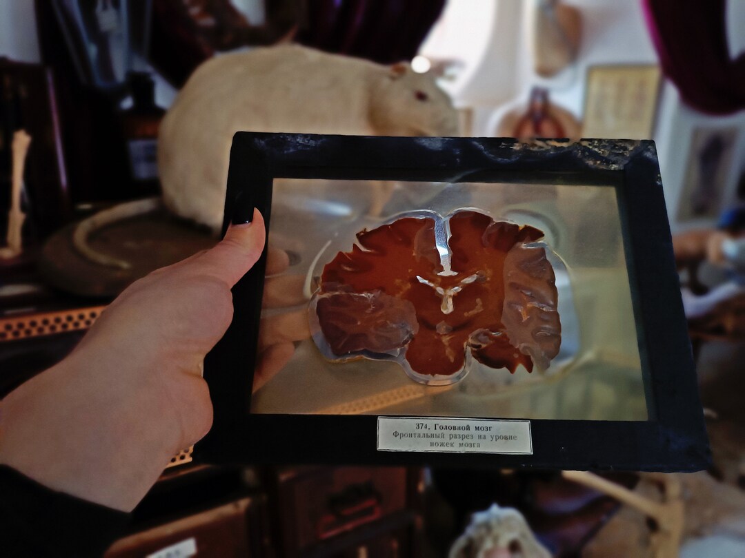 Vintage Real Human Brain Cut Medical Exhibit, Vintage Genuine Human ...