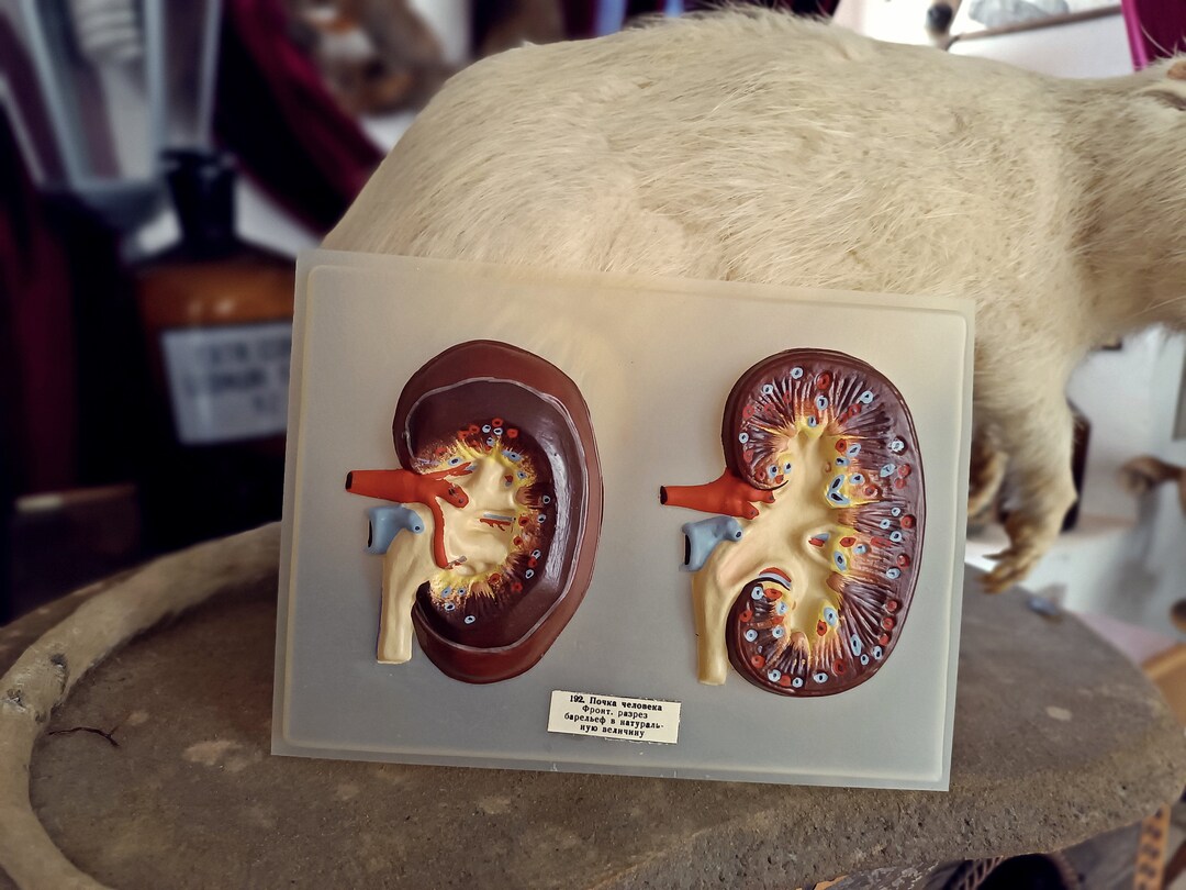Life Size Human Kidney Anatomical Model, Vintage Educational Model ...