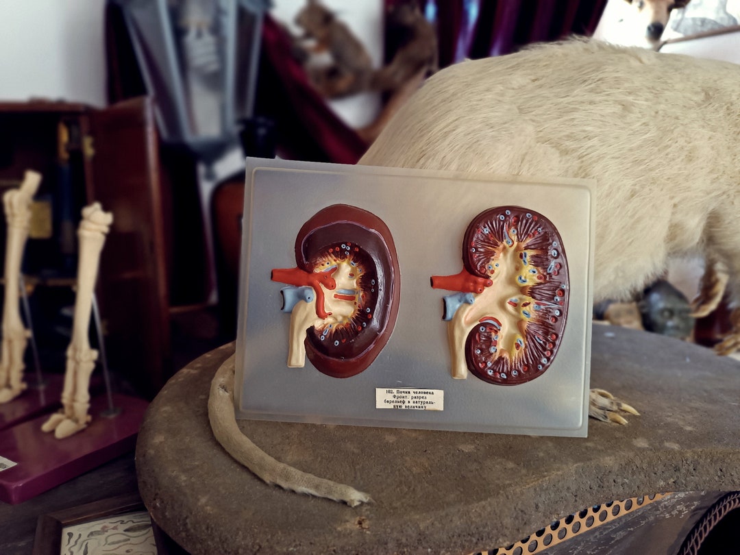 Life Size Human Kidney Anatomical Model, Vintage Educational Model ...