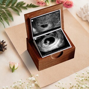 Pull Out Ultrasound Photo Album in Box, Mothers Day Gift, Gift for Mom ...