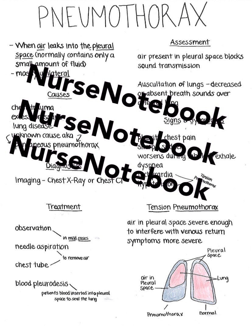 Pneumothorax Quick Clinical Guide for Nursing Students, Nurse ...