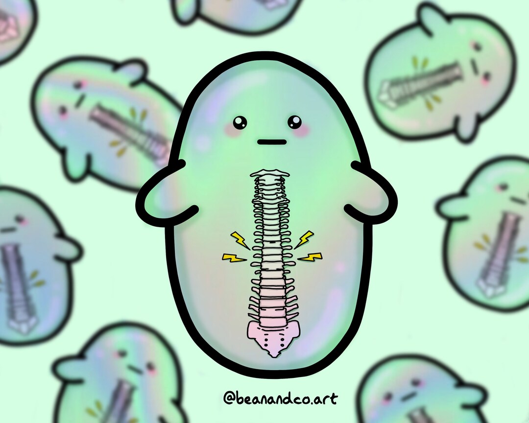 Holographic Spinal Cord Injury Bean Sticker- 5cm Rainbow Gloss Sticker ...