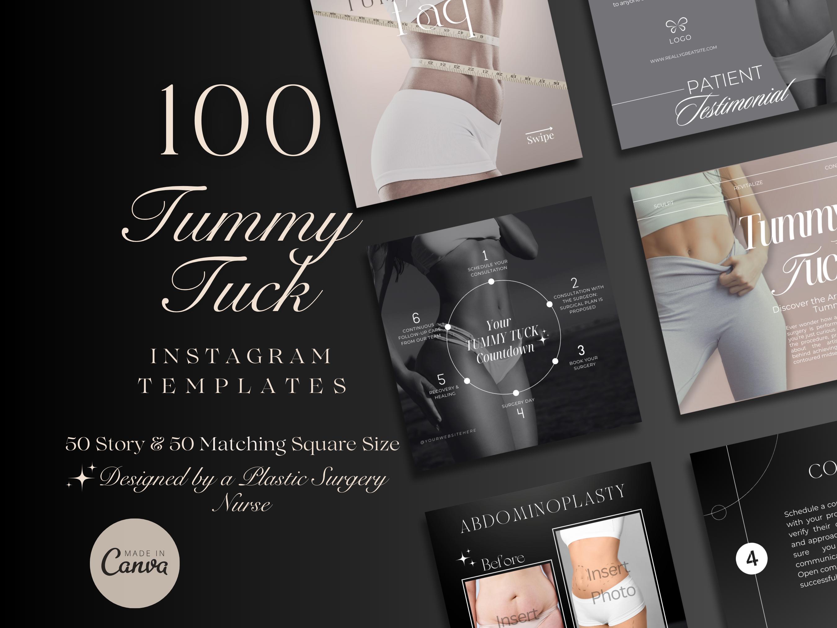 Tummy Tuck Instagram Templates: Plastic Surgery Social Media (100 ...