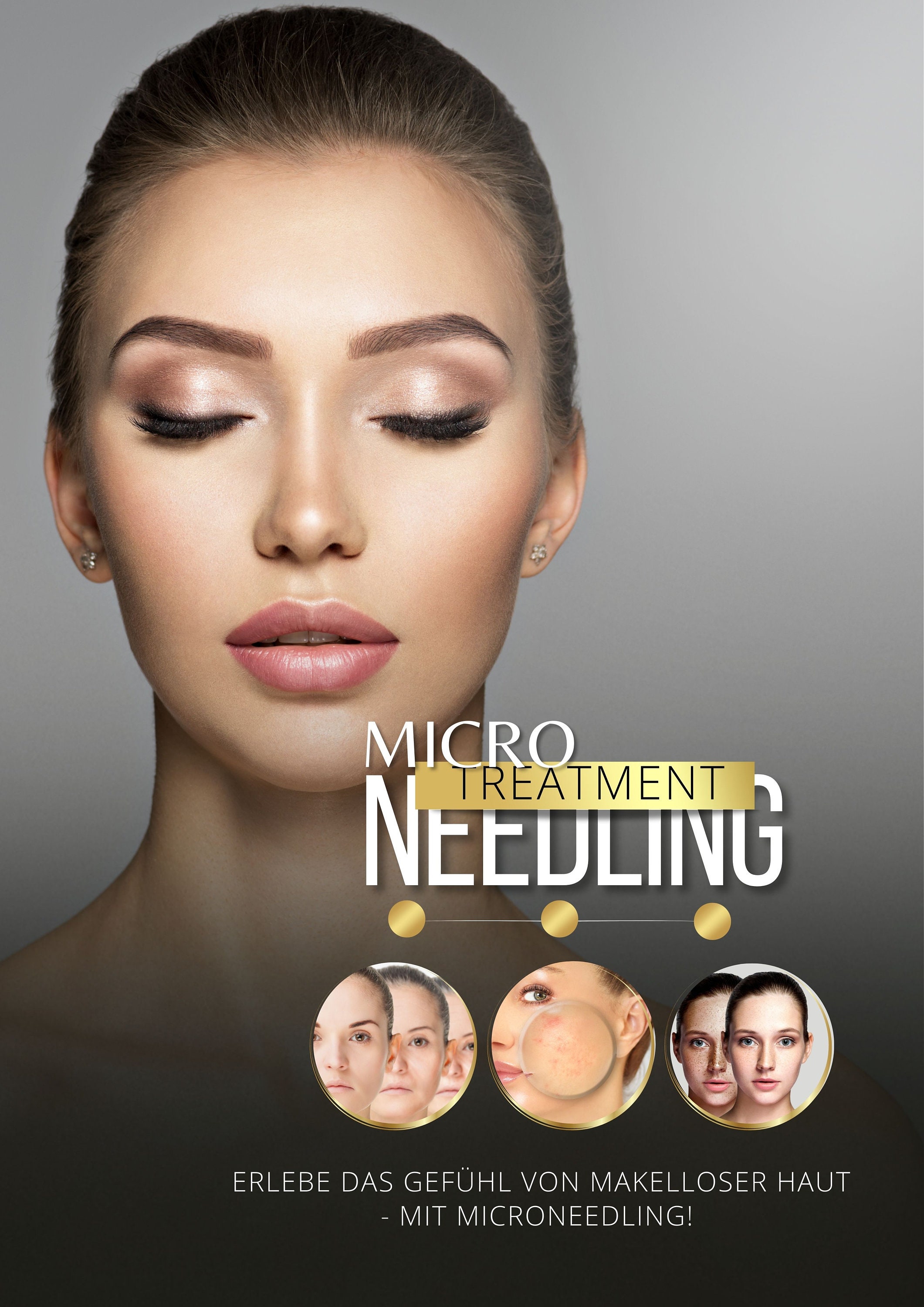 Microneedling Posters, Beauty Posters - Etsy