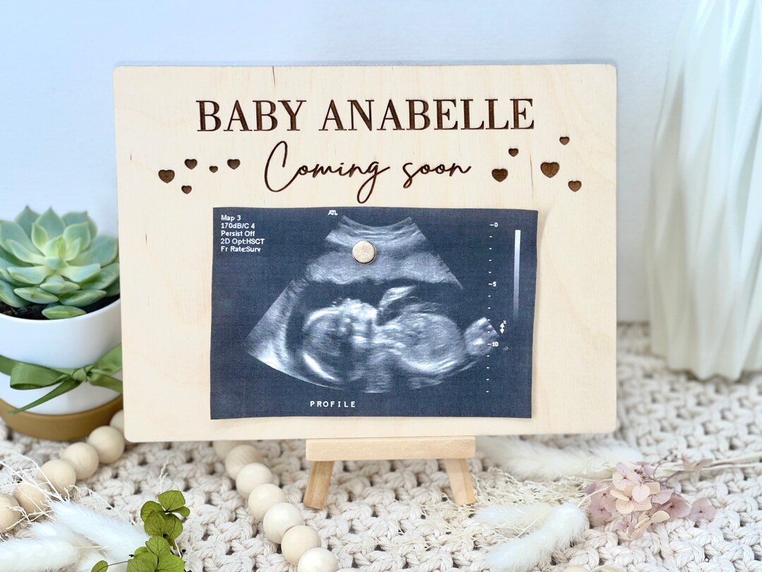 Baby Sonogram Ultrasound Frame Photo Picture Display Sign - Etsy