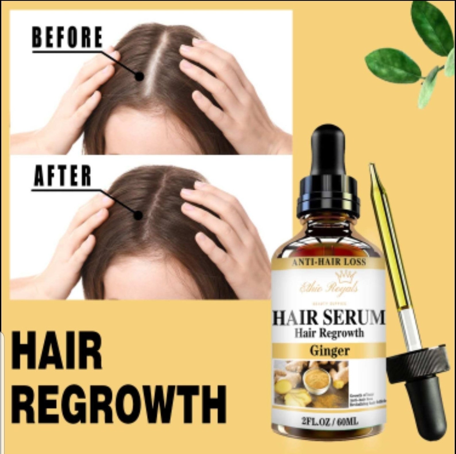 Hair Serum-hair Regrowth Growth Serum Infused With - Etsy