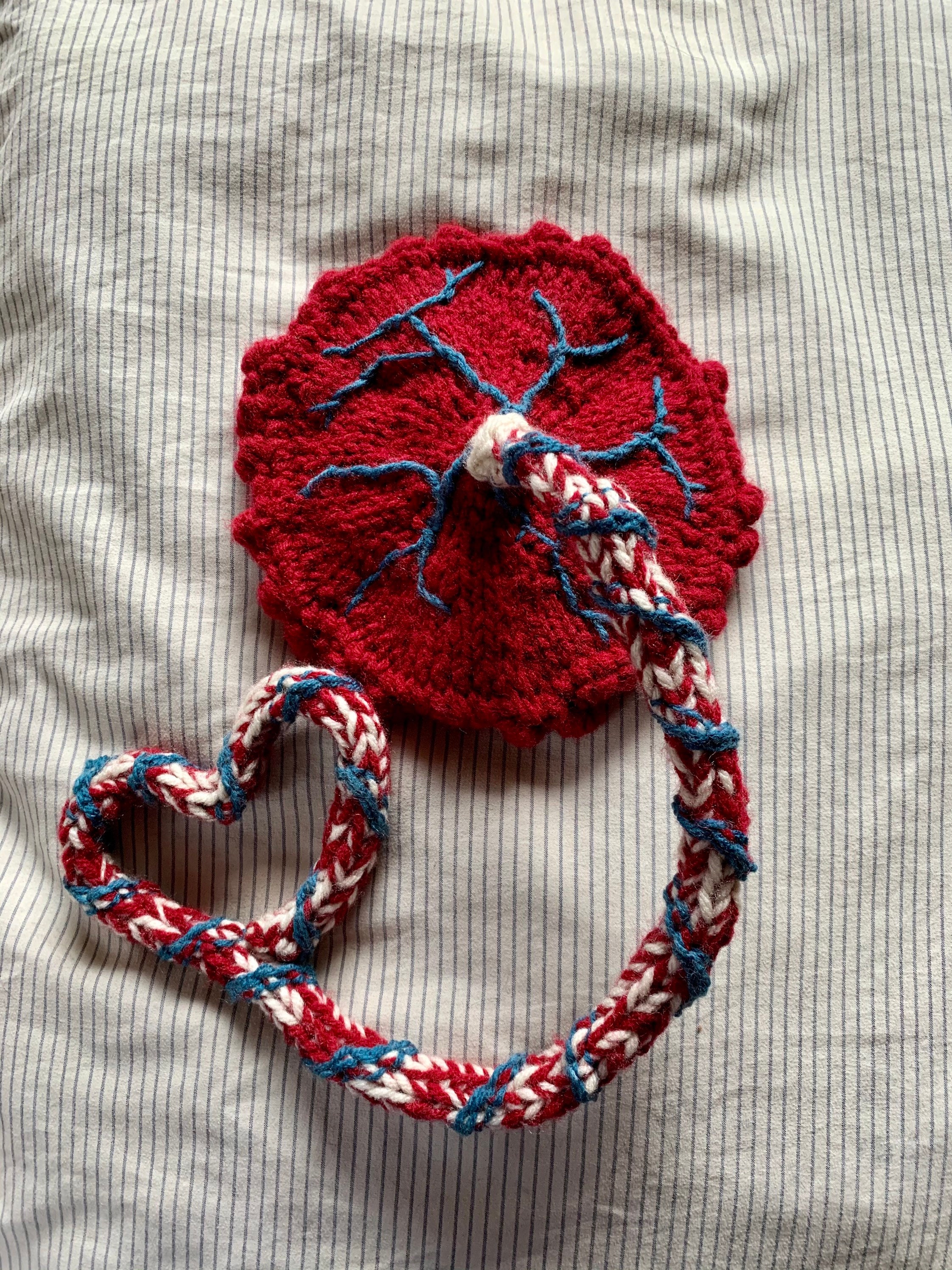 Anatomical Placenta Model - Etsy