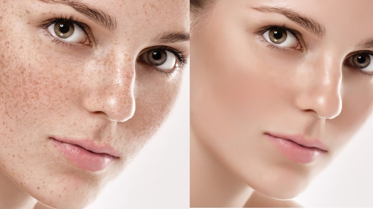 Photo Retouching Service, Photoshop Editing , Pimple Remove , Skin ...