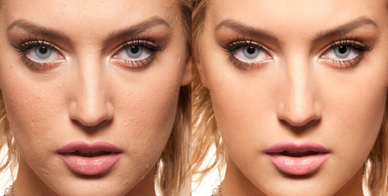Photo Retouching Service, Photoshop Editing , Pimple Remove , Skin ...