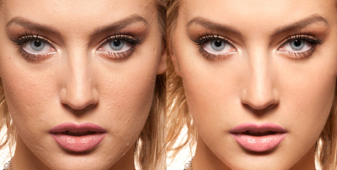 Photo Retouching Service, Photoshop Editing , Pimple Remove , Skin ...