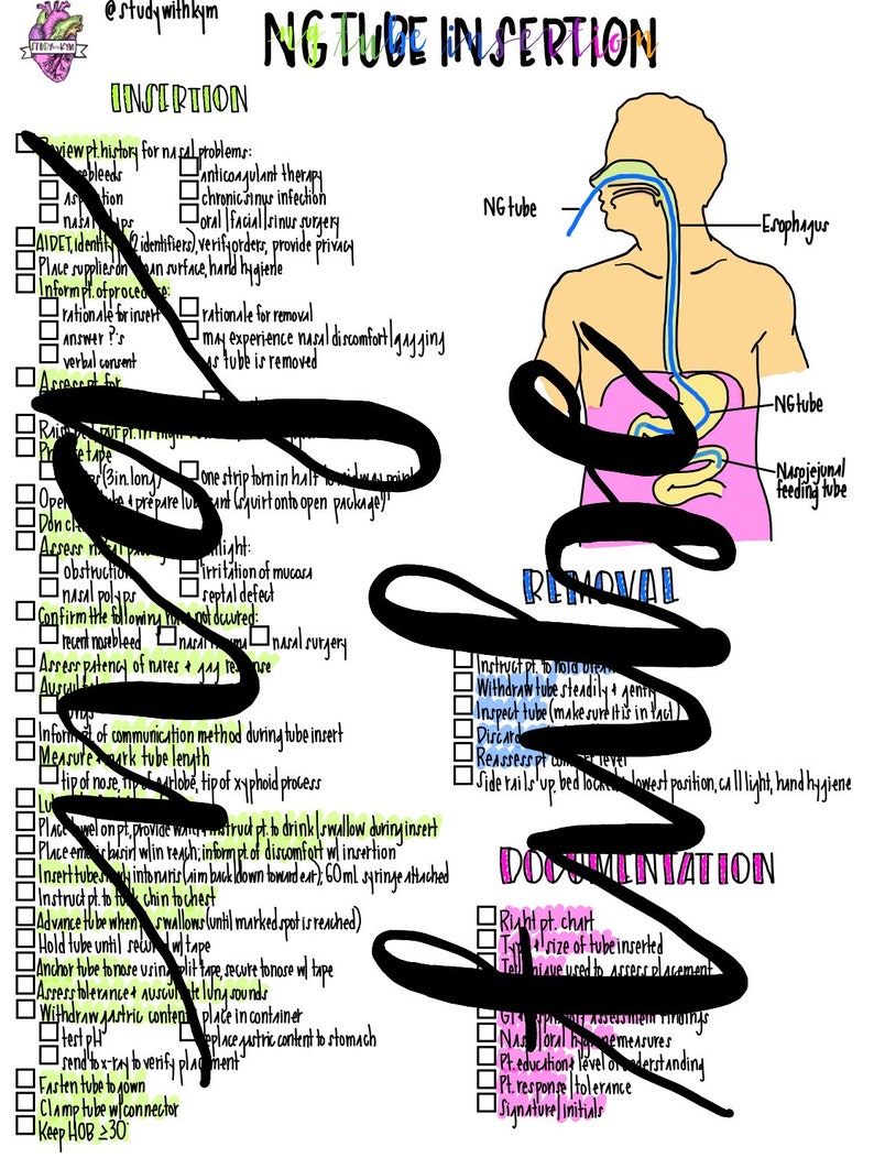 Nasogastric (NG) Tube (skills Cheat Sheet) for Nursing Students - Etsy