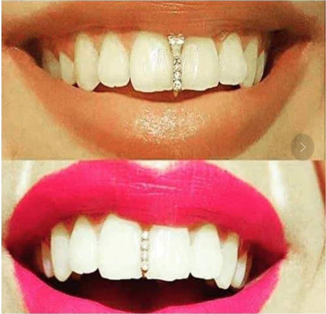 Diamond Tooth
