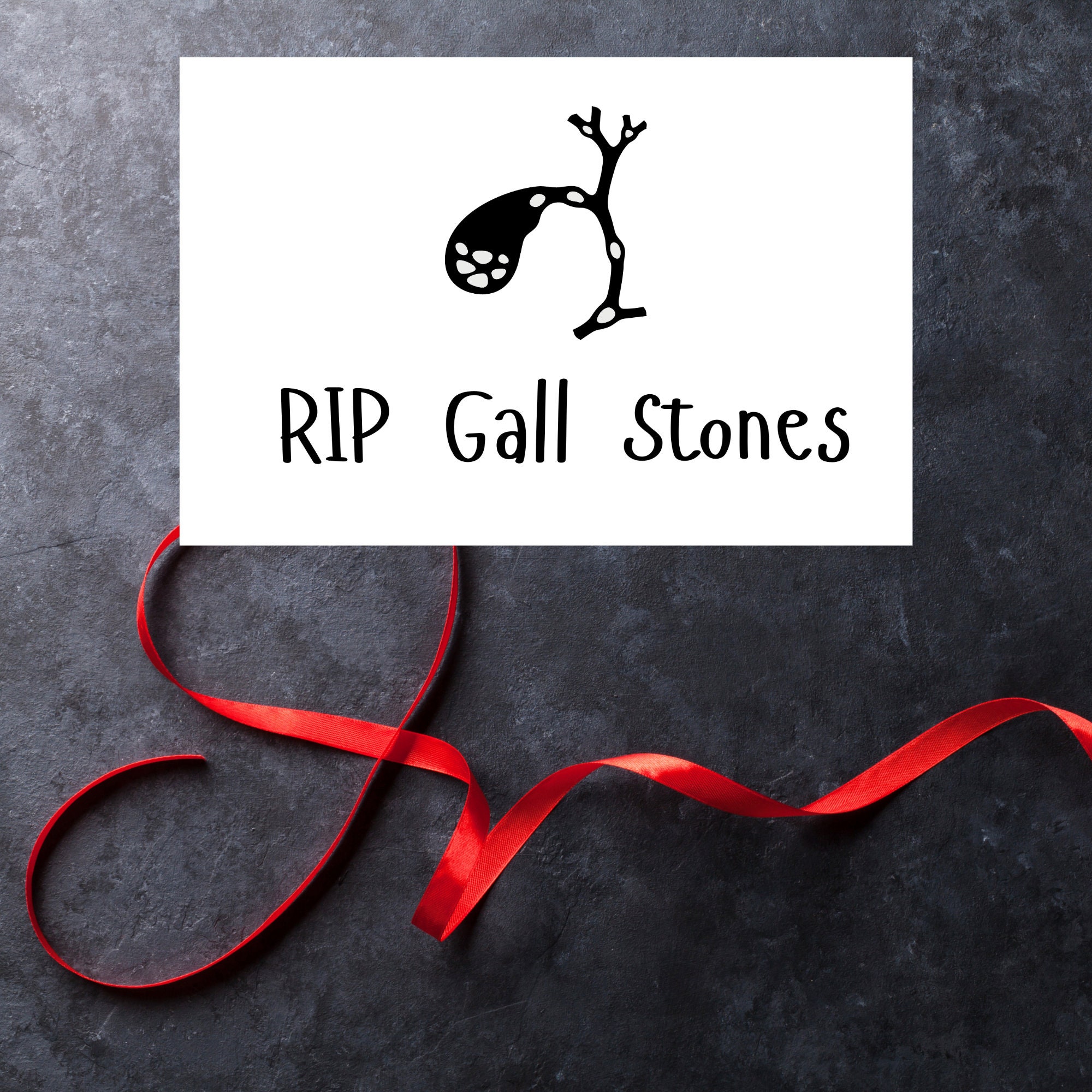 RIP Gallstones, Gallbladder Surgery, Gallbladder Removal, Surgery Card ...