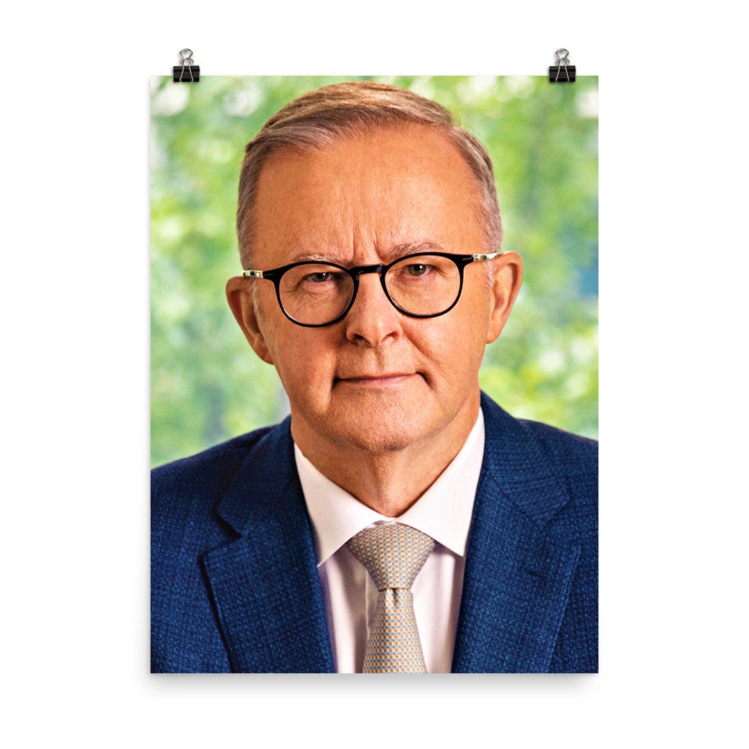 Anthony Albanese Poster Print - Etsy