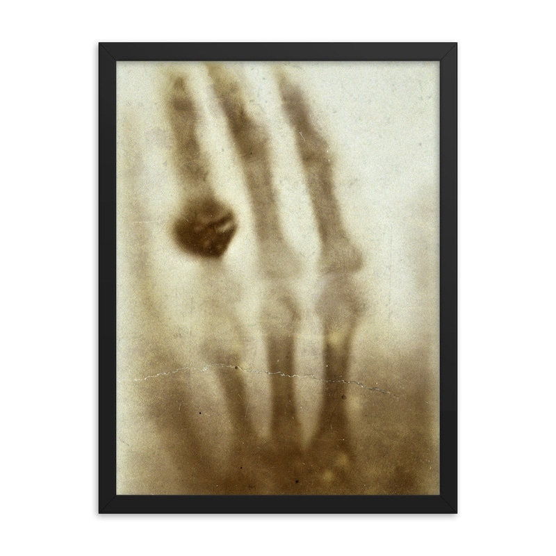 X Ray Henry W. "grote" - Etsy Canada