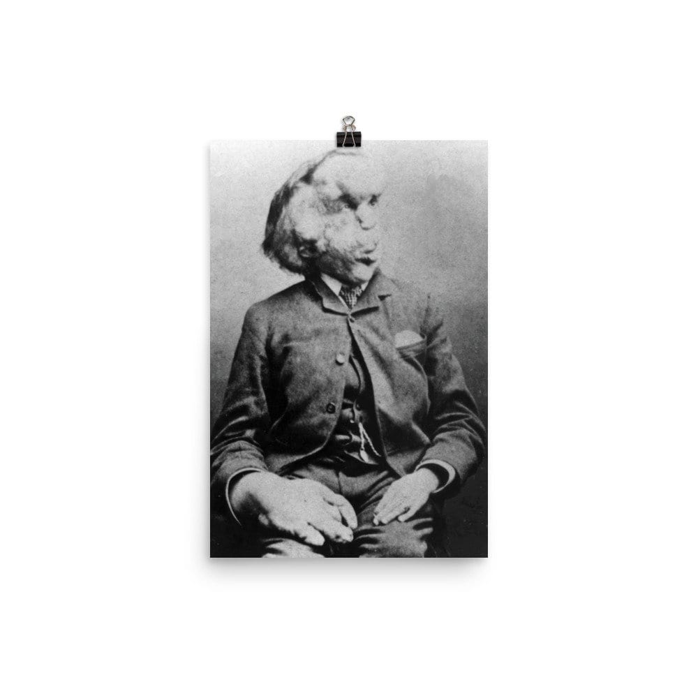 Joseph Merrick the Elephant Man Poster Print - Etsy UK