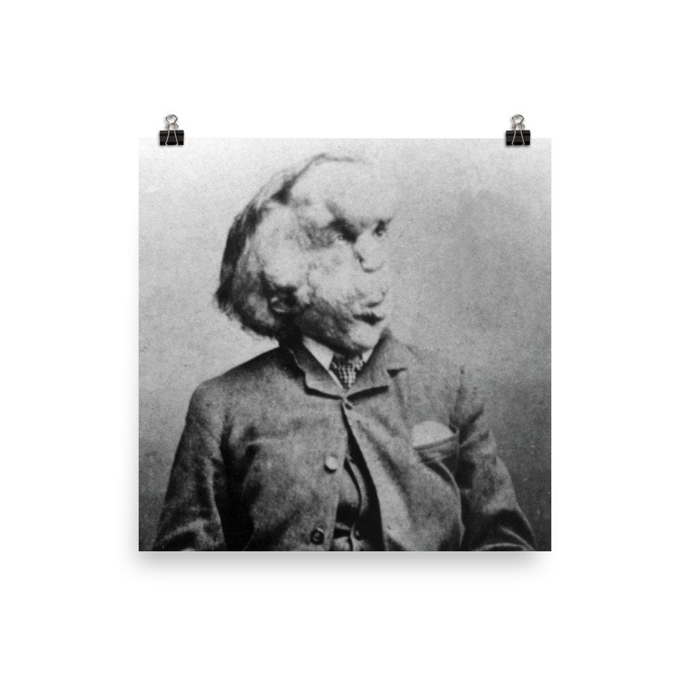 Joseph Merrick the Elephant Man Poster Print - Etsy UK