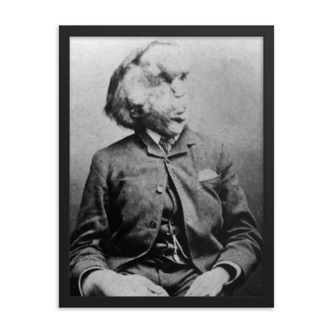Joseph Merrick (the Elephant Man) Framed Print - Etsy