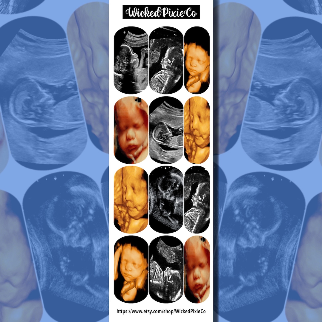 Ultrasound Nail Art Decals Perfect for Gender Reveal or Baby Shower ...