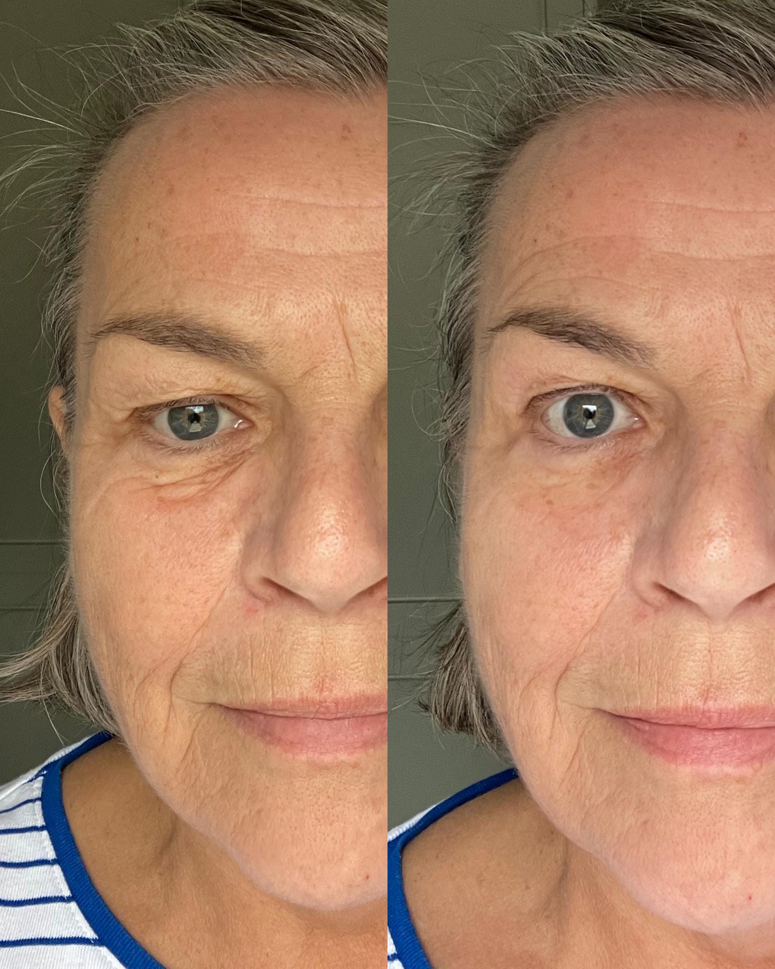 The Original Eyesential (20ml Bottle) Removes Wrinkles, Fine Lines in ...