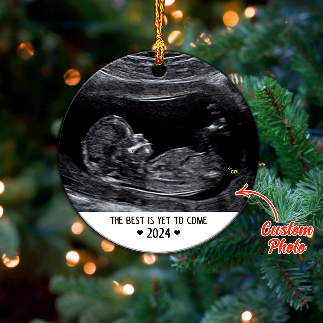 Baby Scan Best yet to Come, Ultrasound Baby Personalized 1st Christmas ...