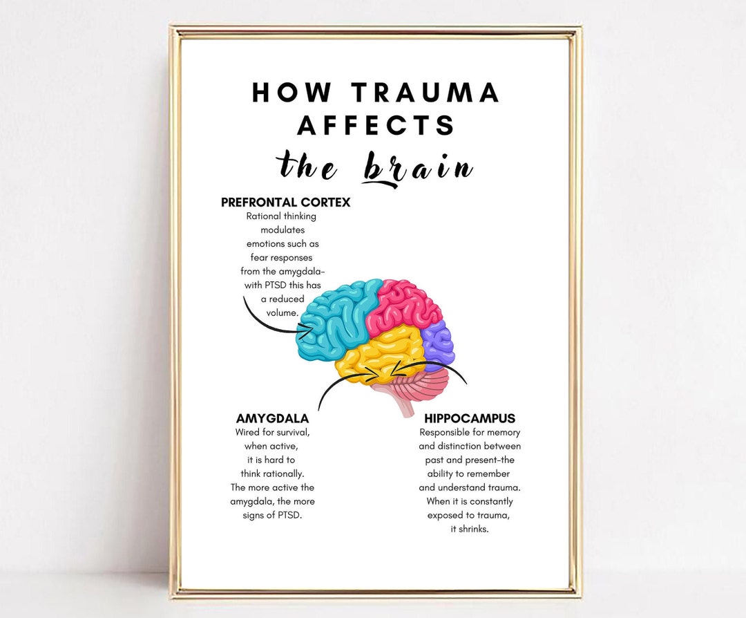 How Trauma Affects the Brain Poster, Therapy Office Decor,dbt Prints ...