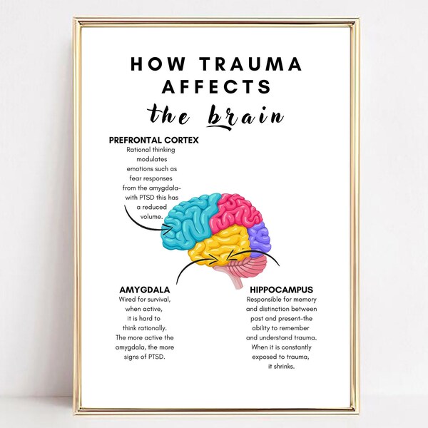 Brain Poster for Office - Etsy