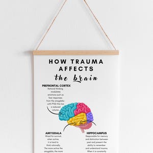 How Trauma Affects the Brain Poster,therapy Office Decor,dbt Prints ...